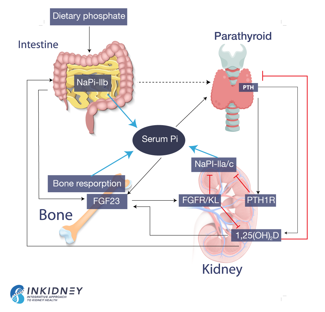 Dietary Phosphorus and Kidney Health — Integrative Kidney